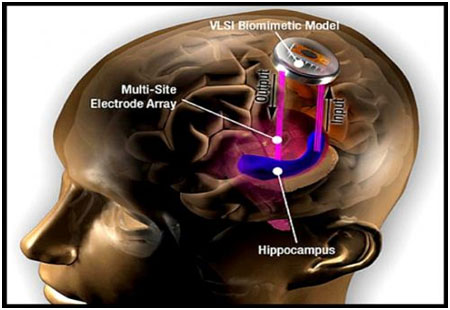 Brain Memory Implants: Something to Remember