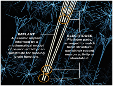 Brain Memory Implants: Something to Remember