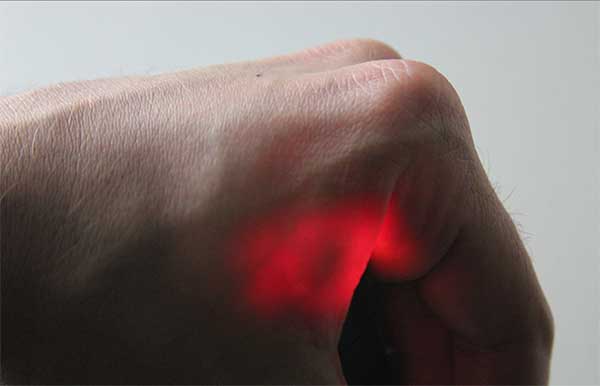 Biohacking Implants: Technology beyond Wearables