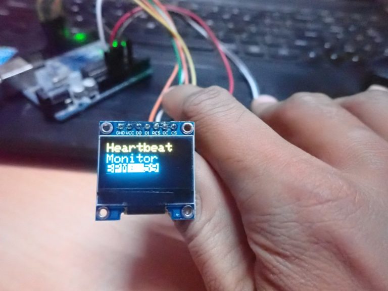 Arduino Projects - Heartbeat Monitor with graphical heartbeat display Arduino Projects - Heartbeat Monitor with graphical heartbeat display